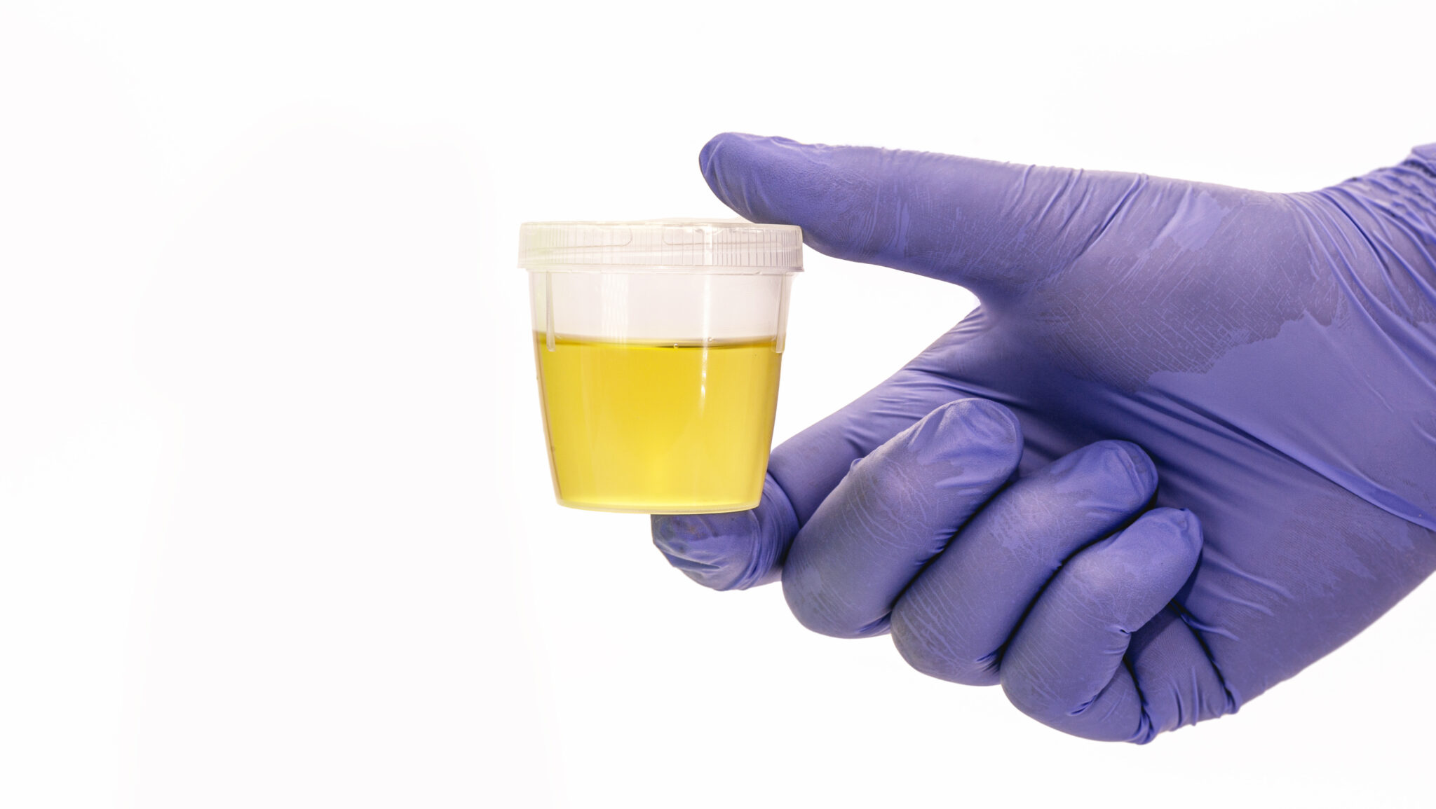 Can You Really Drink Urine Through A LifeStraw? The Surprising Answer ...
